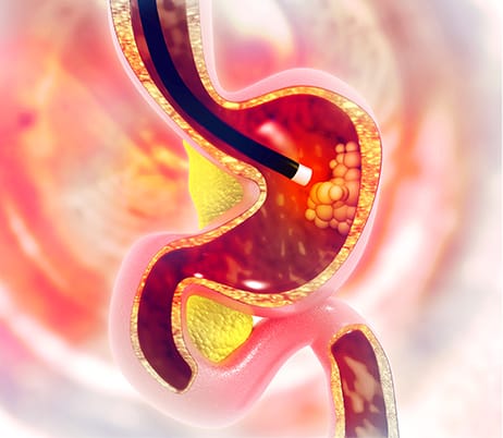 Pain Management & Gastroenterology Procedures | GI Doctors South ...